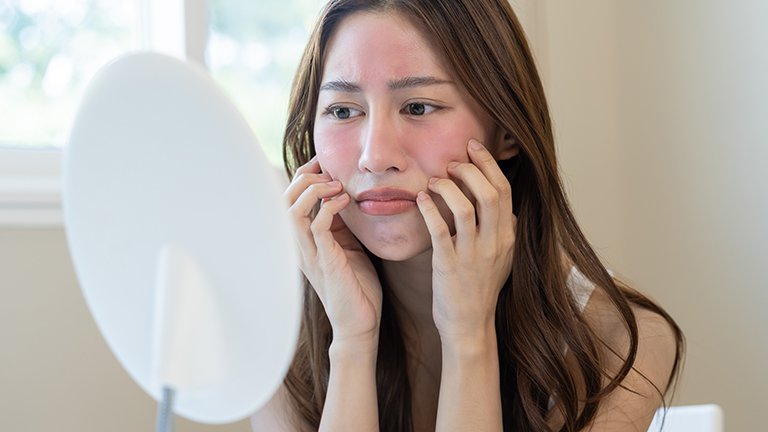 5 Cara Mengatasi Kulit Wajah Yang Kering Dan Gatal Dengan Aman