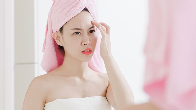 Mudah! Ini 8 Cara Menghilangkan Bruntusan di Jidat