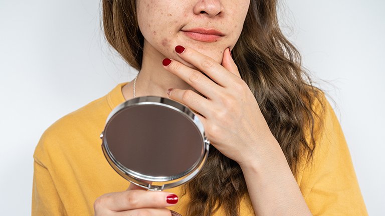 5 Contoh Skin Barrier Rusak dan Cara Merawatnya, Cek di sini!