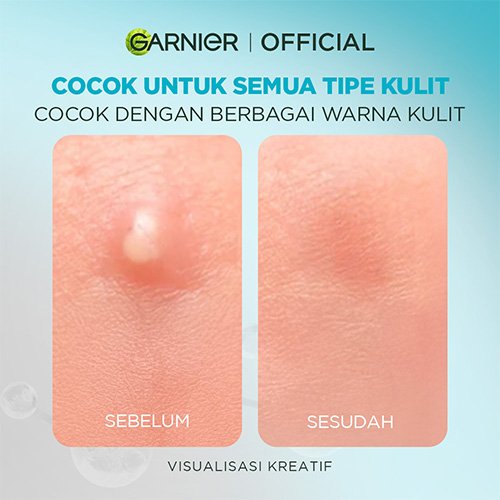 Garnier Pimple Patch Invisible